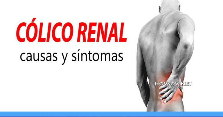 Cólico renal: causas y síntomas HOYSOY.NET ️